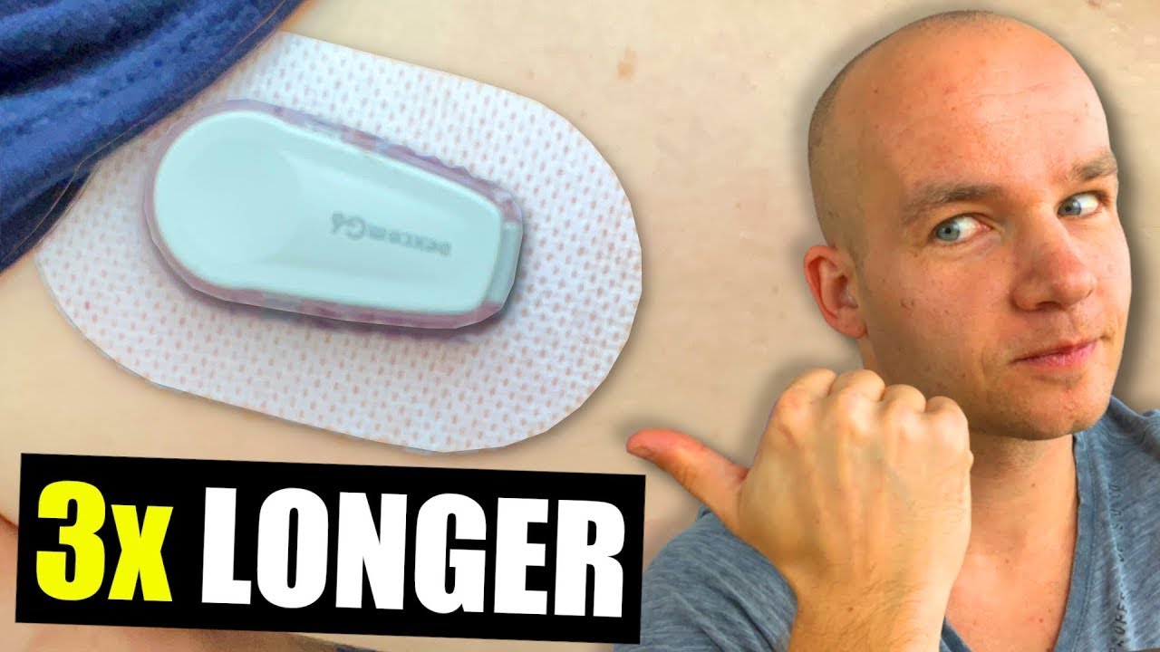 How To Extend Dexcom G6 Transmitter? - Capa Learning